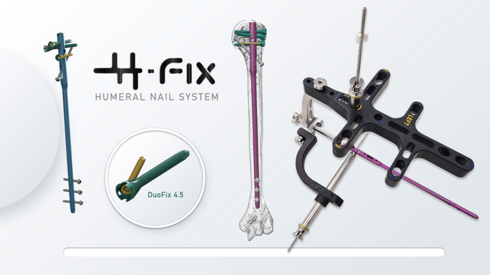 H-Fix Clavo Intramedular para Húmero - Traufix Mexico